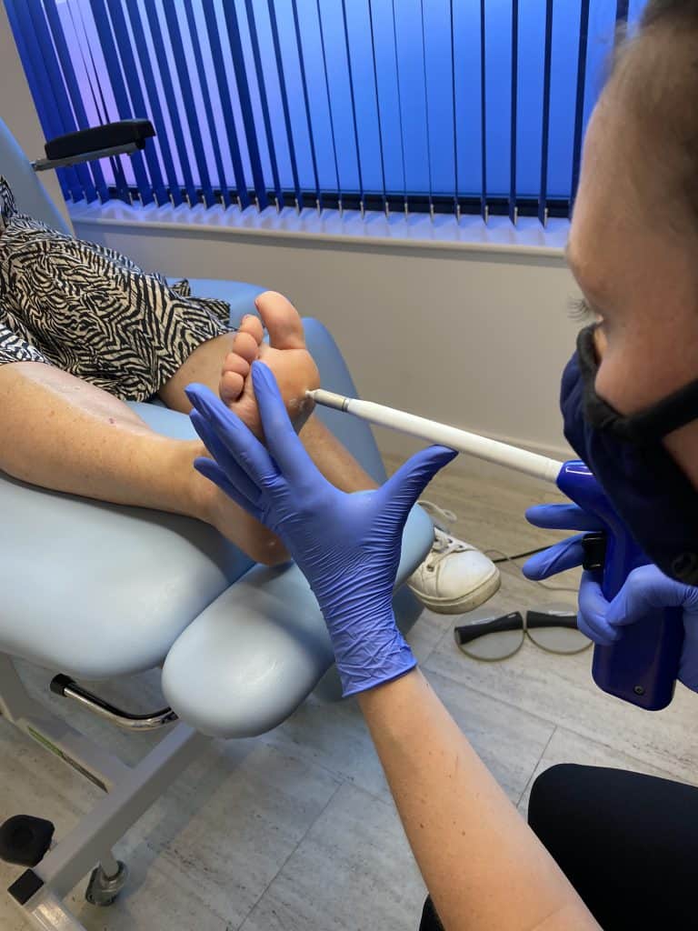 Verrucae Treatment - Randell's Footcare